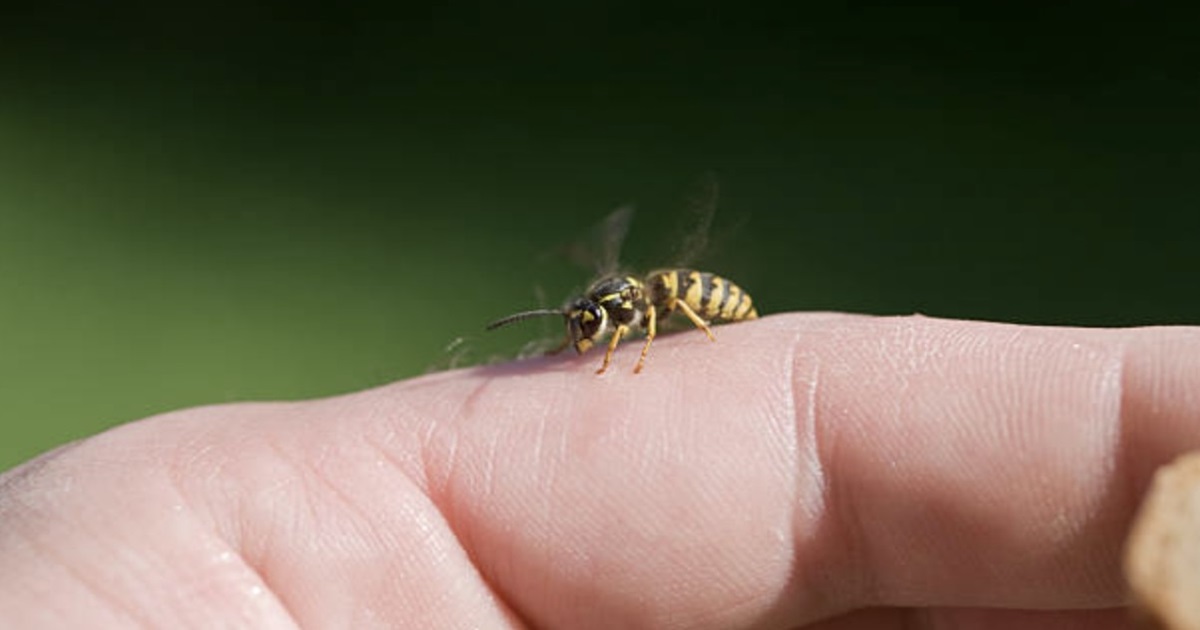 What to Do If You’re Stung by a Wasp: Quick Remedies & Prevention Tips ...